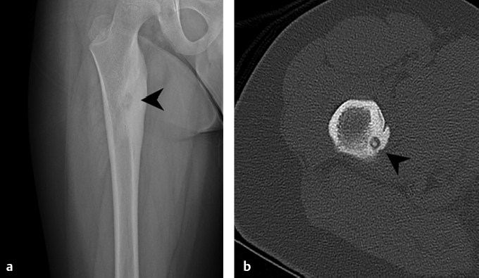 Pediatric IR | Radiology Key