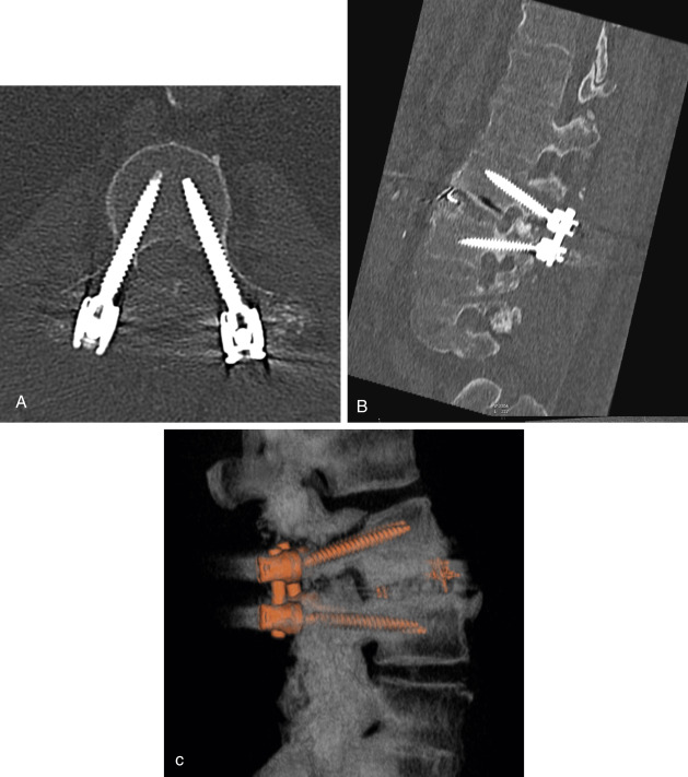 CT in Musculoskeletal Nontrauma | Radiology Key