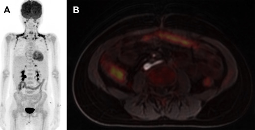 PET/MR Imaging: | Radiology Key