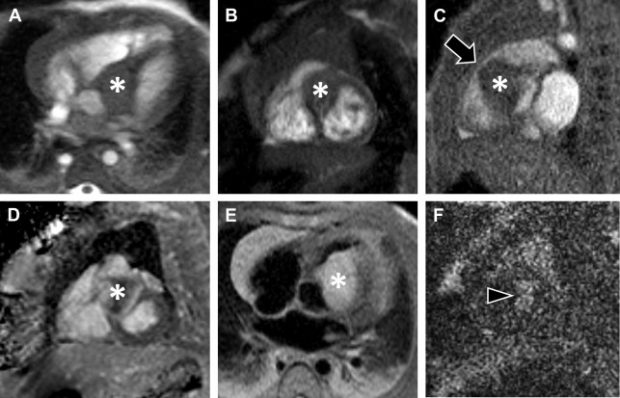 MR Physics in Practice | Radiology Key
