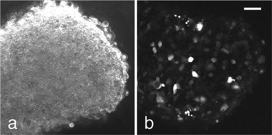 Vital Imaging of Multicellular Spheroids | Radiology Key