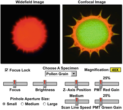 Confocal Microscopy on the Internet | Radiology Key