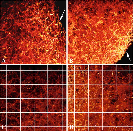 Confocal Microscopy of Cardiac Myocytes | Radiology Key