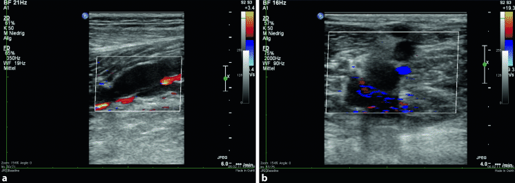 Arterien und Venen | Radiology Key