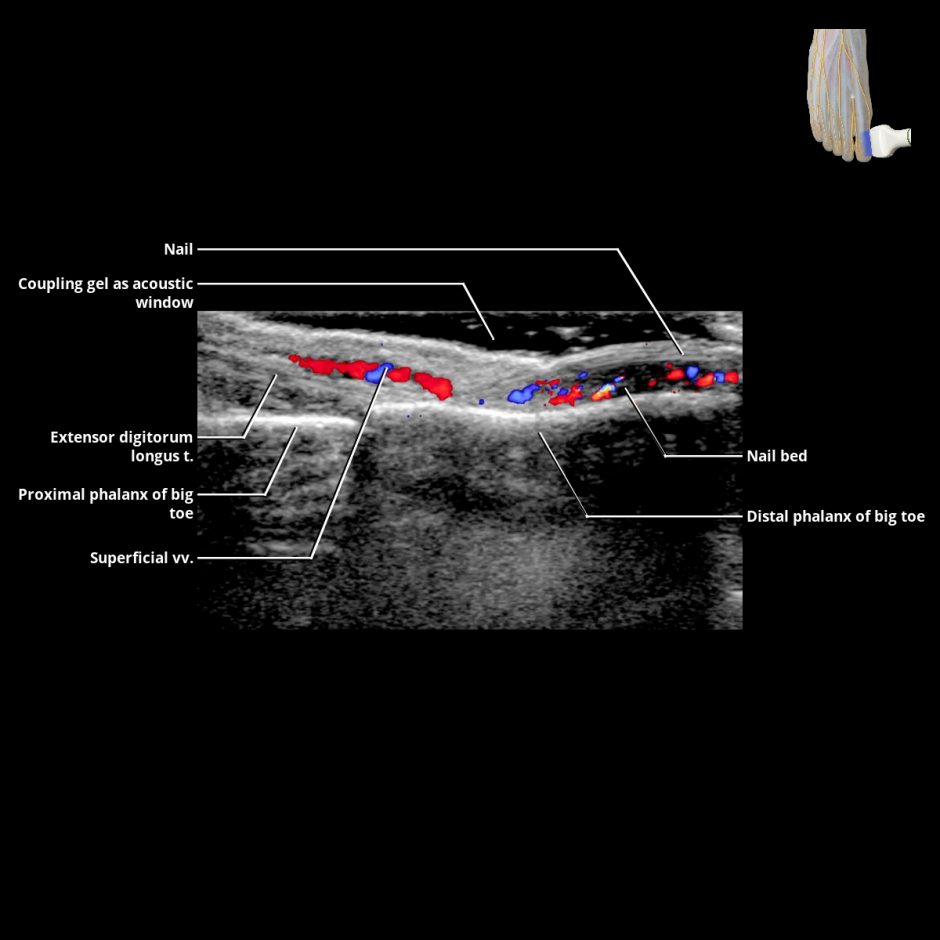 Hand | Radiology Key