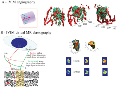 Introduction to IVIM MRI | Radiology Key
