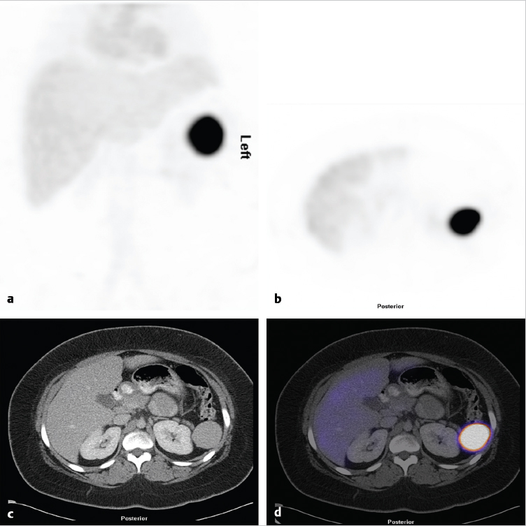 10 SPECT in Children | Radiology Key