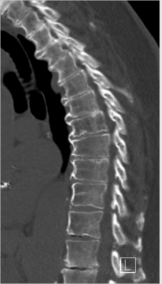 7 Detection and Management of Unexpected Incidental Pulmonary and ...