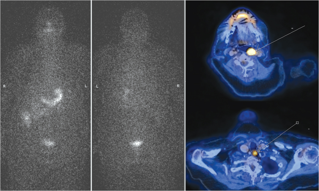 Part 2 Thyroid and Parathyroid | Radiology Key