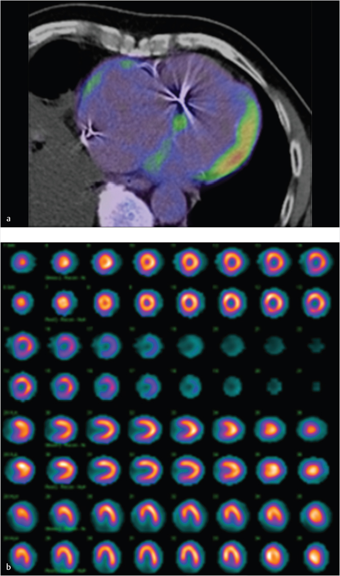 Part 3 Cardiac | Radiology Key