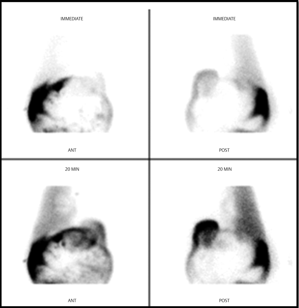 Part 6 Gastrointestinal Radiology Key