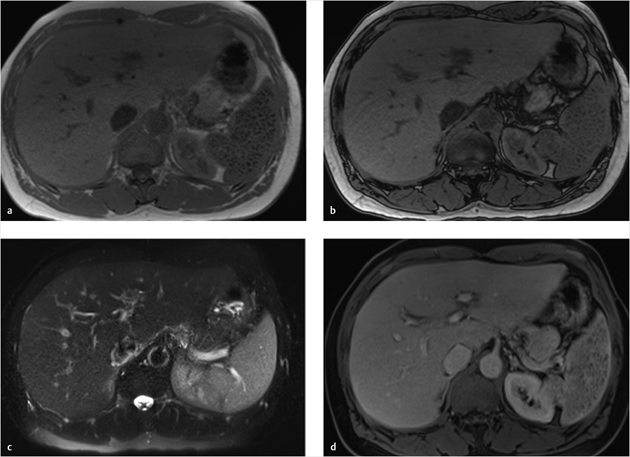 Part 2 Pancreas and Spleen | Radiology Key