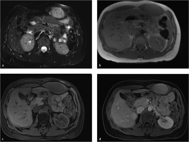 Part 5 Abdominal Wall and Soft Tissues | Radiology Key