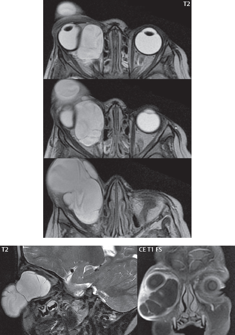 Orbit | Radiology Key