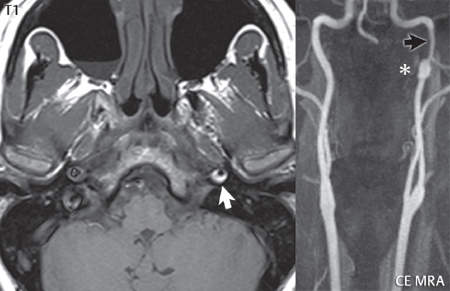 Soft Tissues of the Neck | Radiology Key