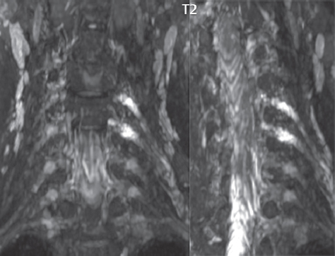 Trauma | Radiology Key