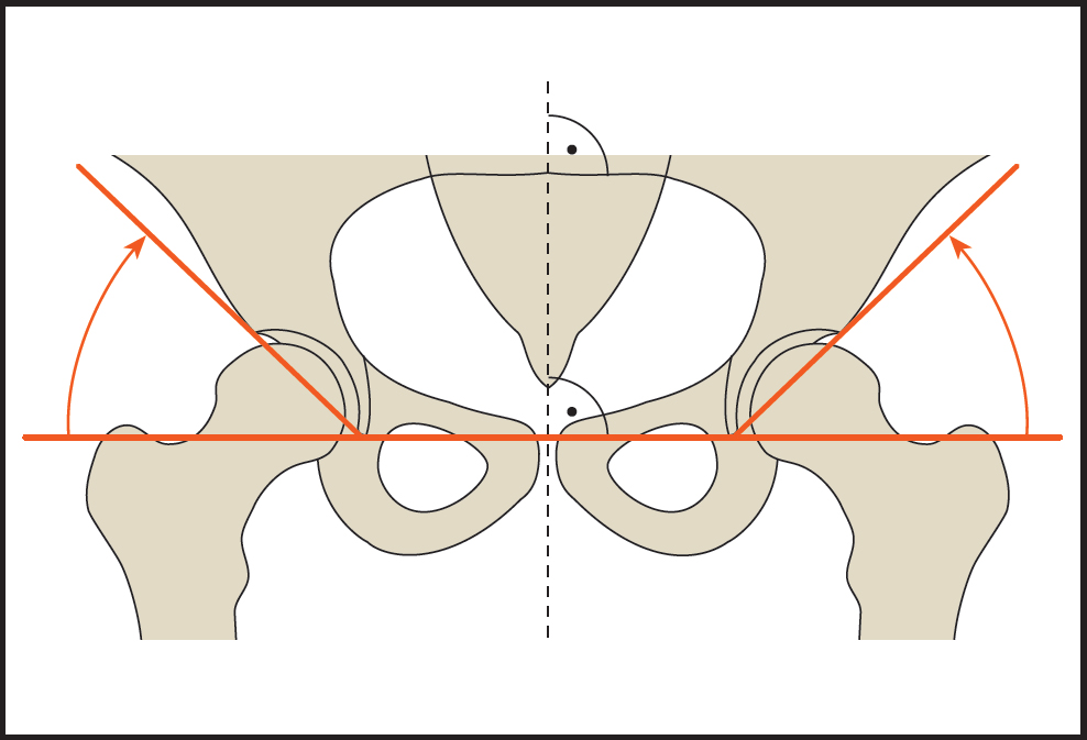 Hip(I) | Radiology Key