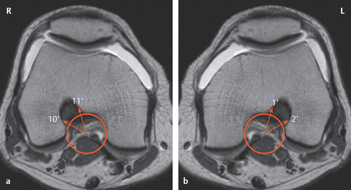 Knee | Radiology Key
