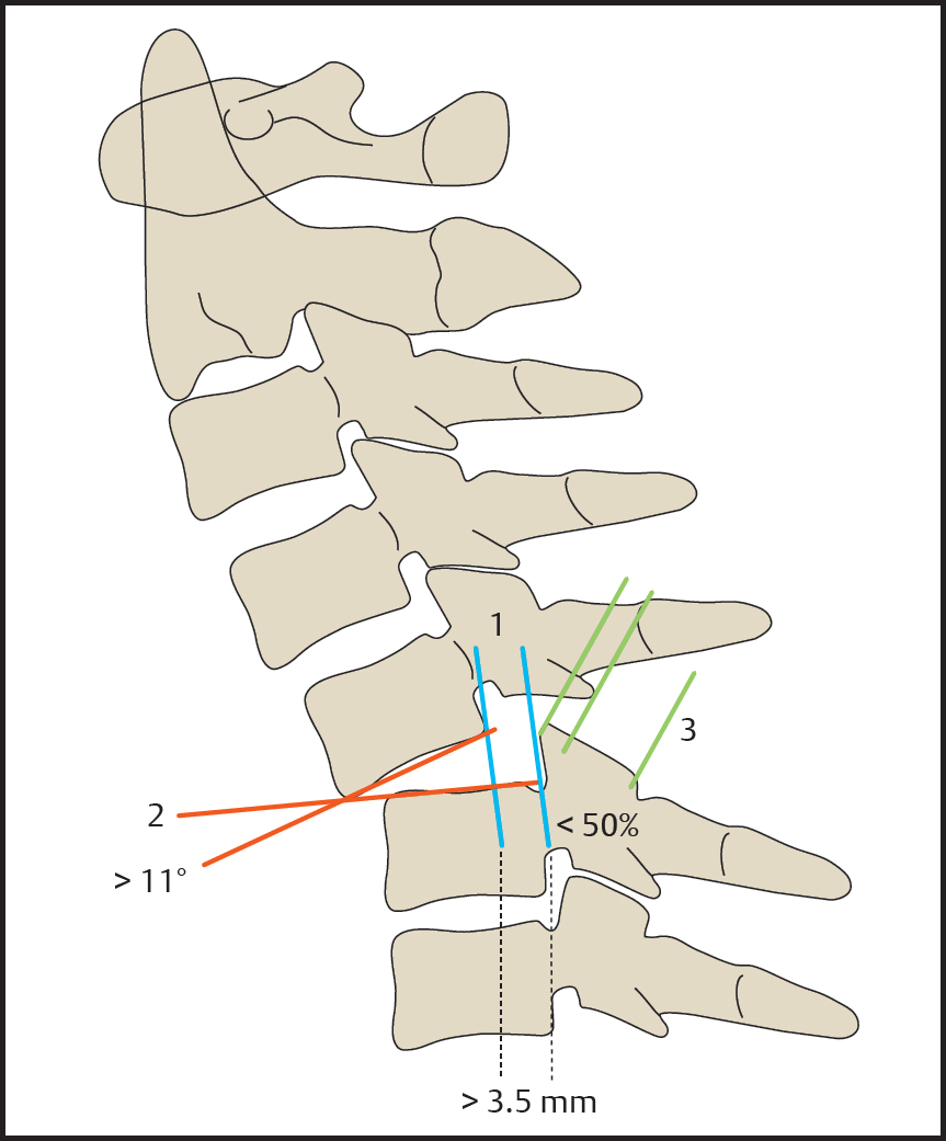 Craniocervical Junction and Cervical Spine | Radiology Key