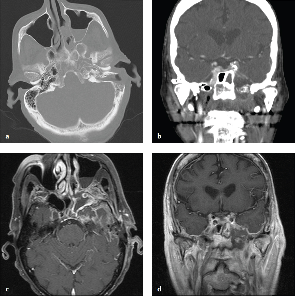 3 Head and Neck | Radiology Key