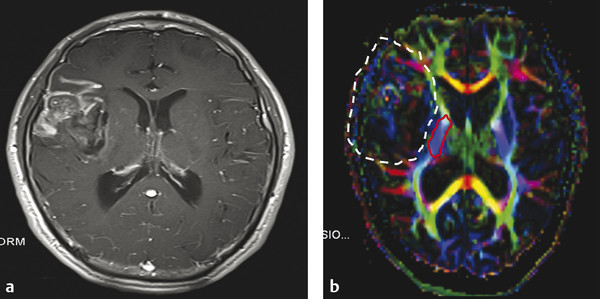 3 Going Beyond the Conventional Morphological Imaging: An Overview of ...