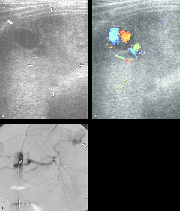 10 Spleen | Radiology Key