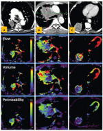 CT Perfusion Imaging Principles | Radiology Key