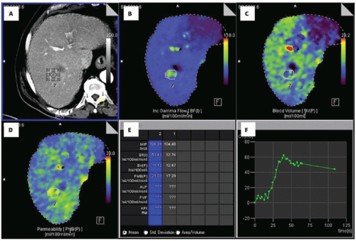 Liver Perfusion Imaging with CT | Radiology Key