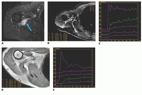 Musculoskeletal Perfusion Imaging | Radiology Key