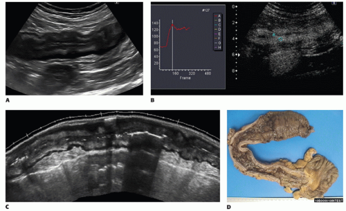 Contrast-Enhanced Ultrasound: Clinical Applications | Radiology Key