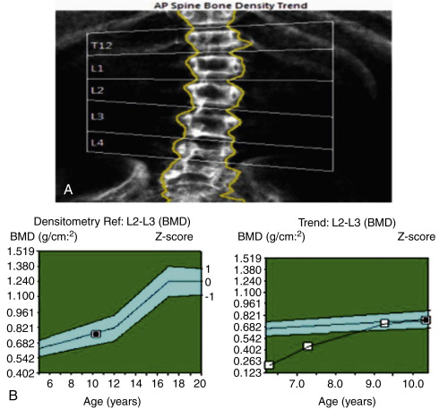 The Skeletal System | Radiology Key