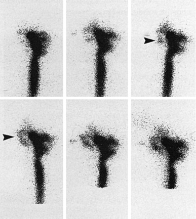 Central Nervous System | Radiology Key