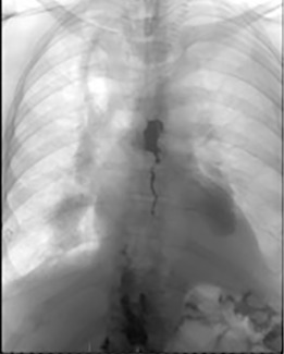 Angiography and Interventions | Radiology Key