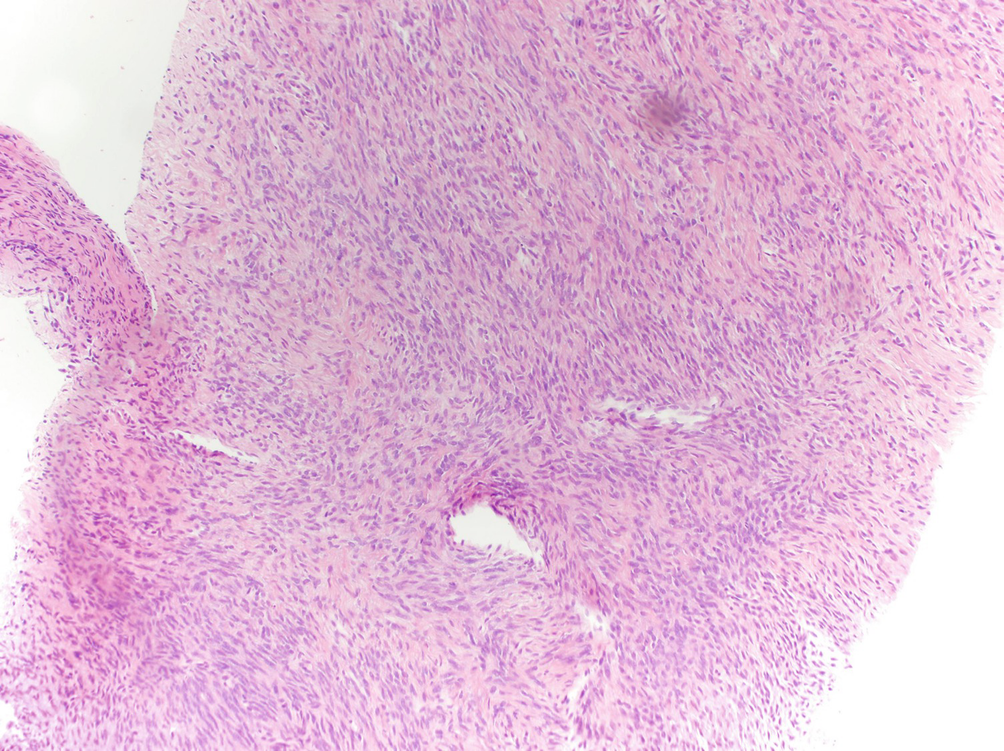 and Soft Tissue Tumors | Radiology Key