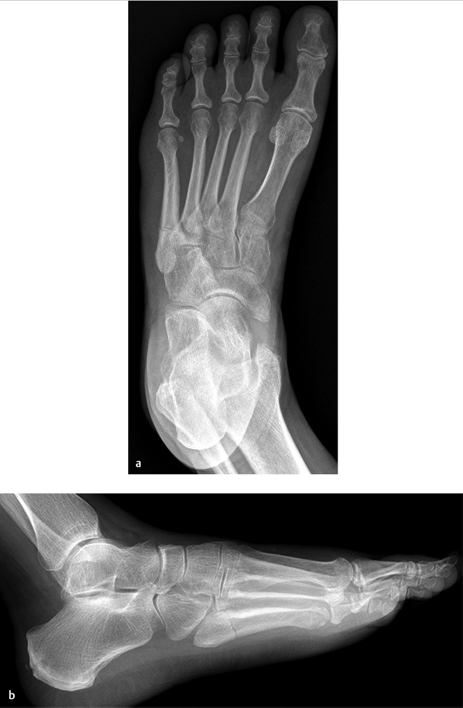 Part 1: Trauma | Radiology Key