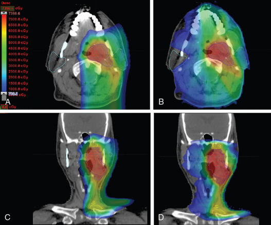 Head and neck | Radiology Key