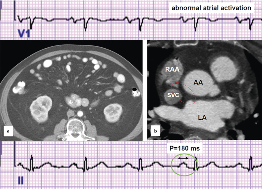 20 The Pericardium | Radiology Key