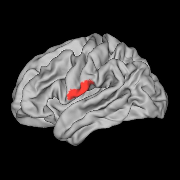 Insula and Parainsula Areas (Areas 13, 43) | Radiology Key