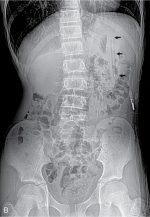 ALARA principles | Radiology Key