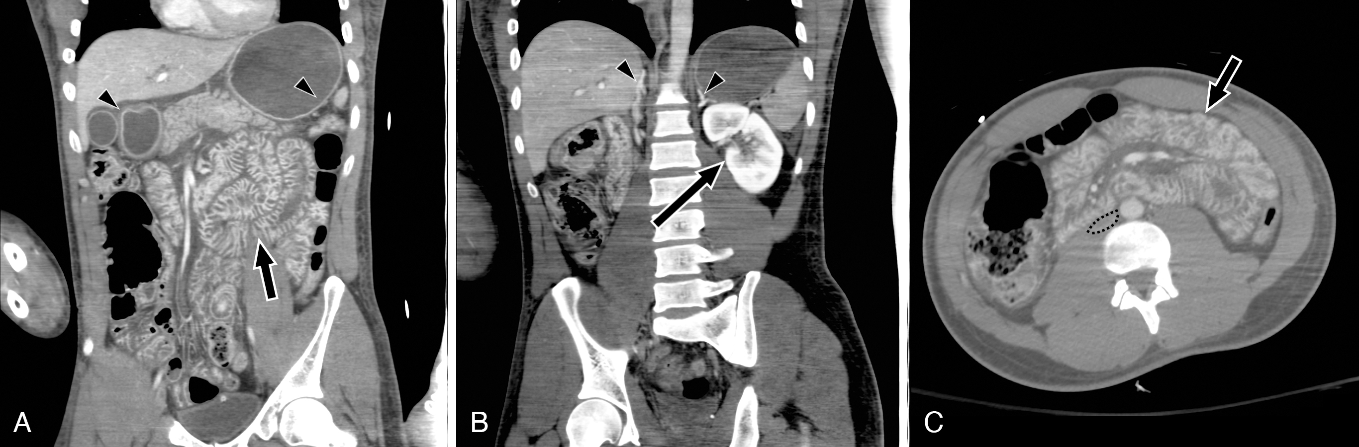 Abdominal/pelvic trauma | Radiology Key
