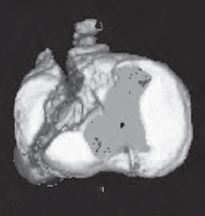 Lower Extremity | Radiology Key