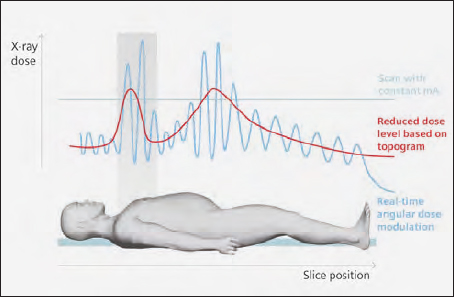 Radiation Safety | Radiology Key