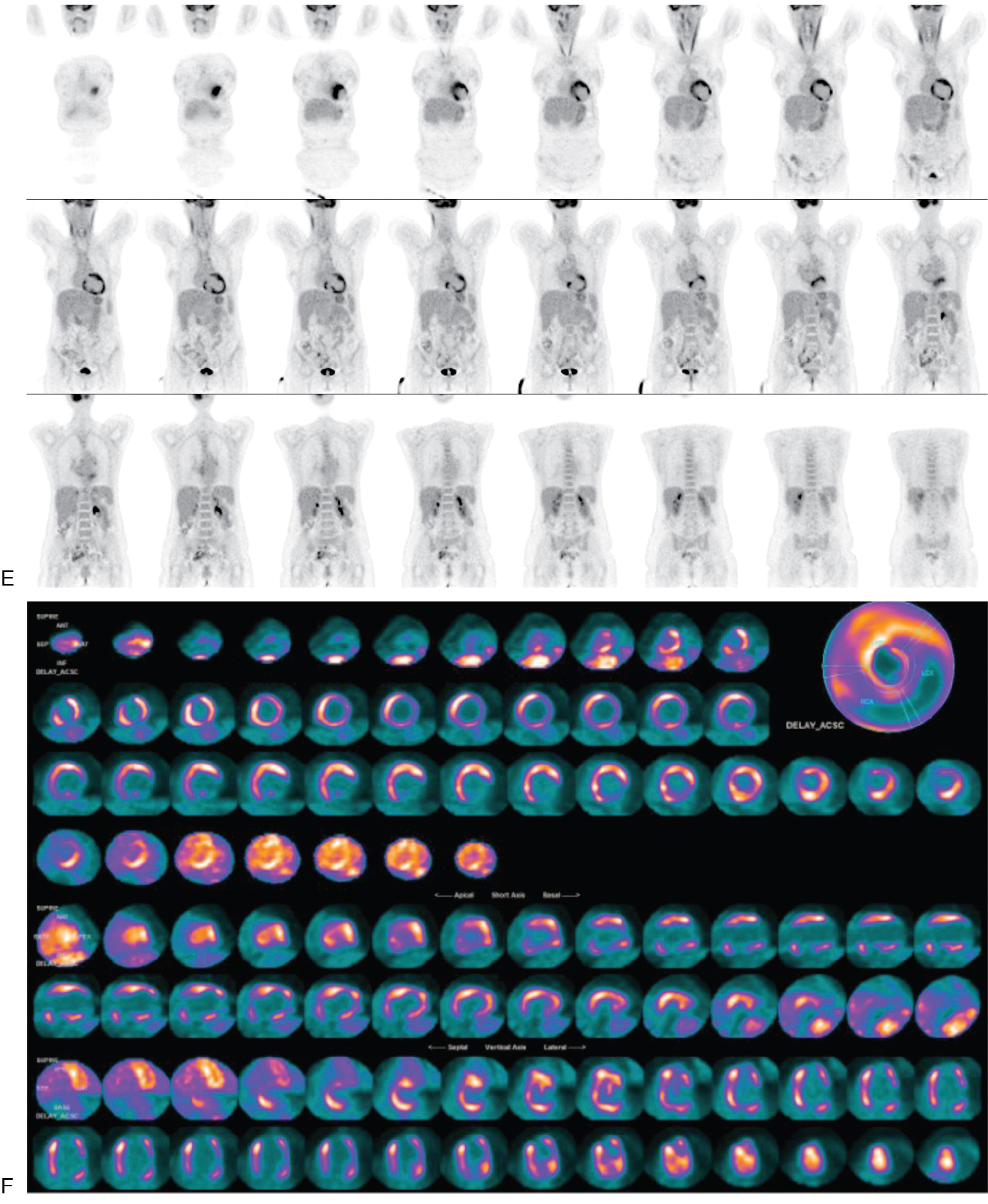 The patient with new-onset heart failure | Radiology Key