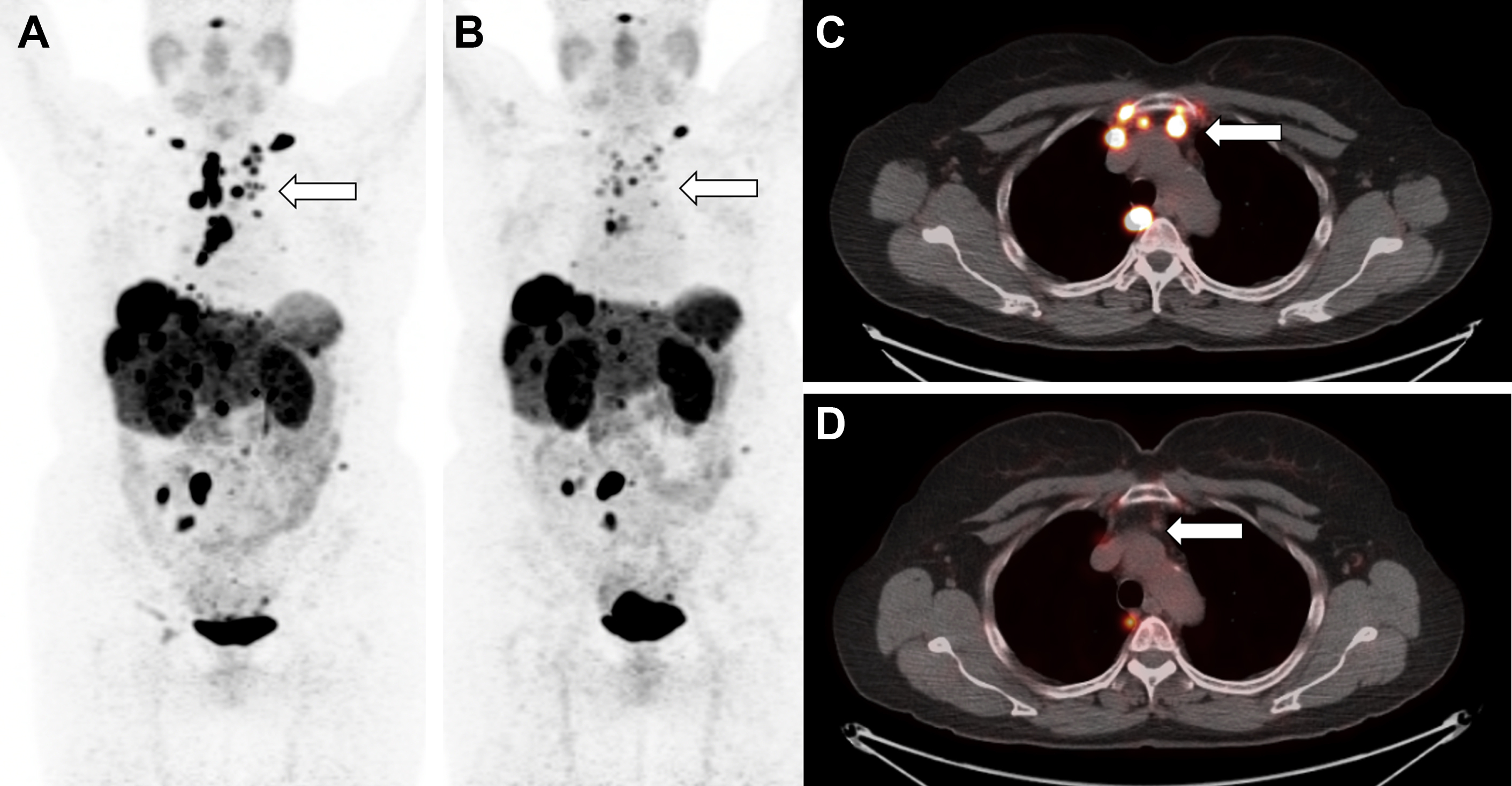 PET Imaging of Neuroendocrine Tumors | Radiology Key