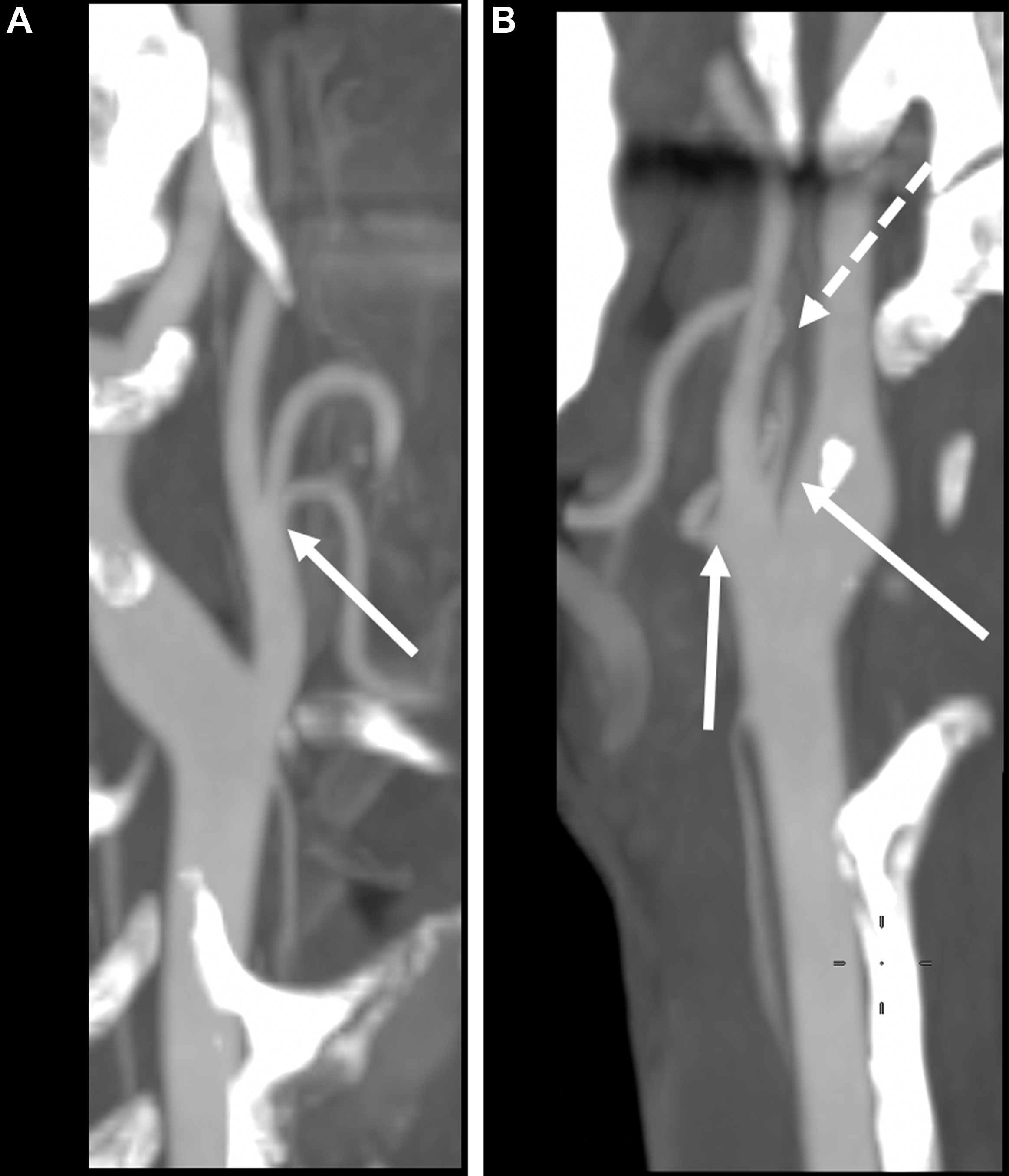 Imaging of Facial Reconstruction and Face Transplantation | Radiology Key
