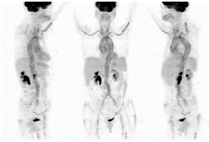 Infection and Inflammation | Radiology Key