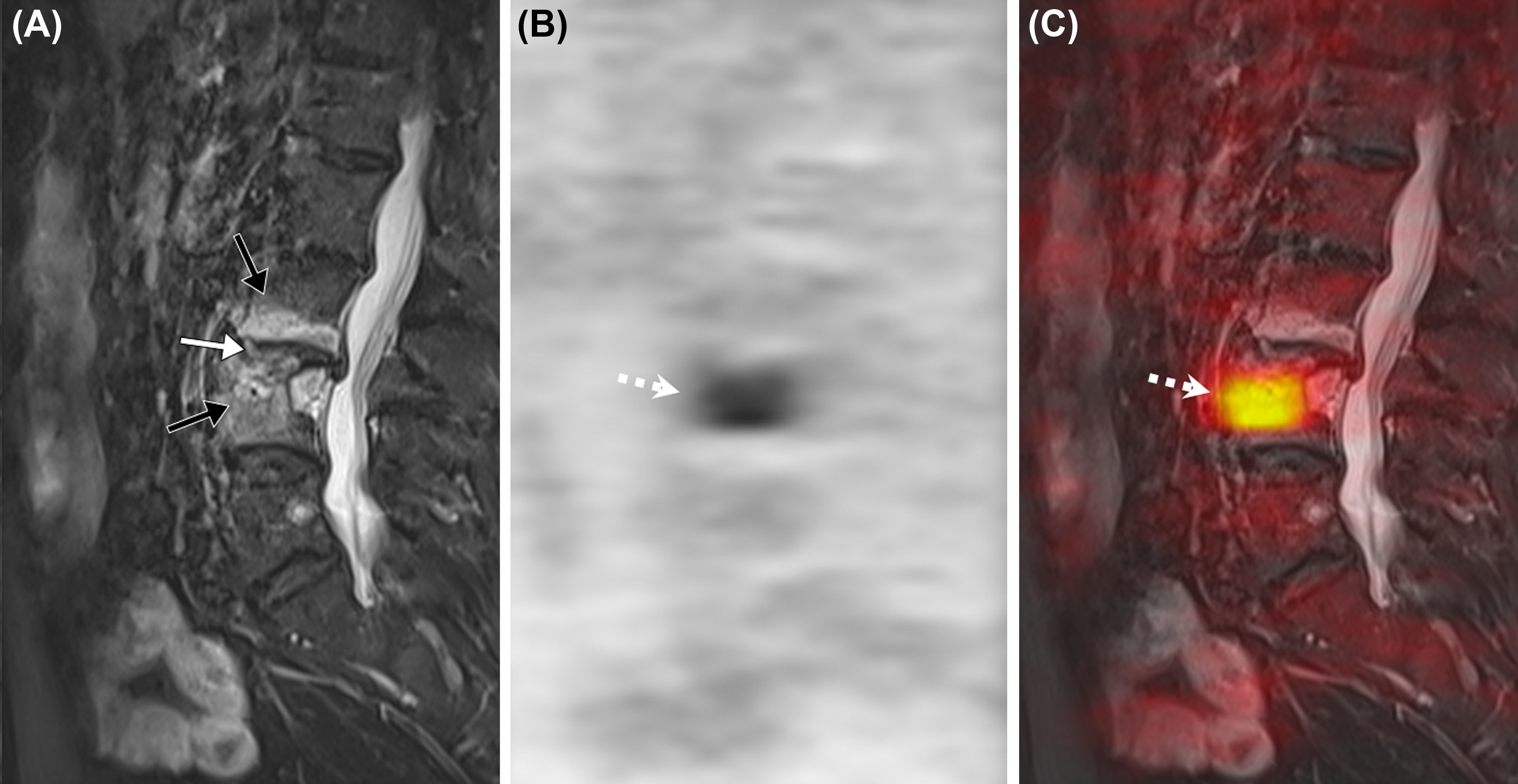 Musculoskeletal imaging | Radiology Key