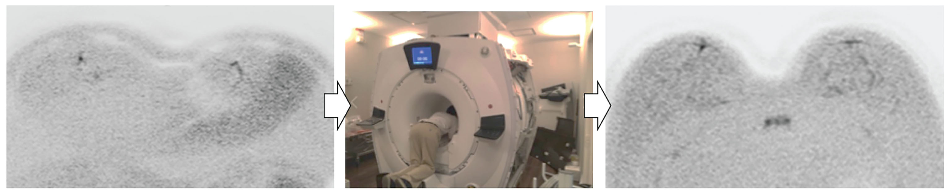 Diffusion-Weighted Whole Body Imaging With Background Body Signal ...