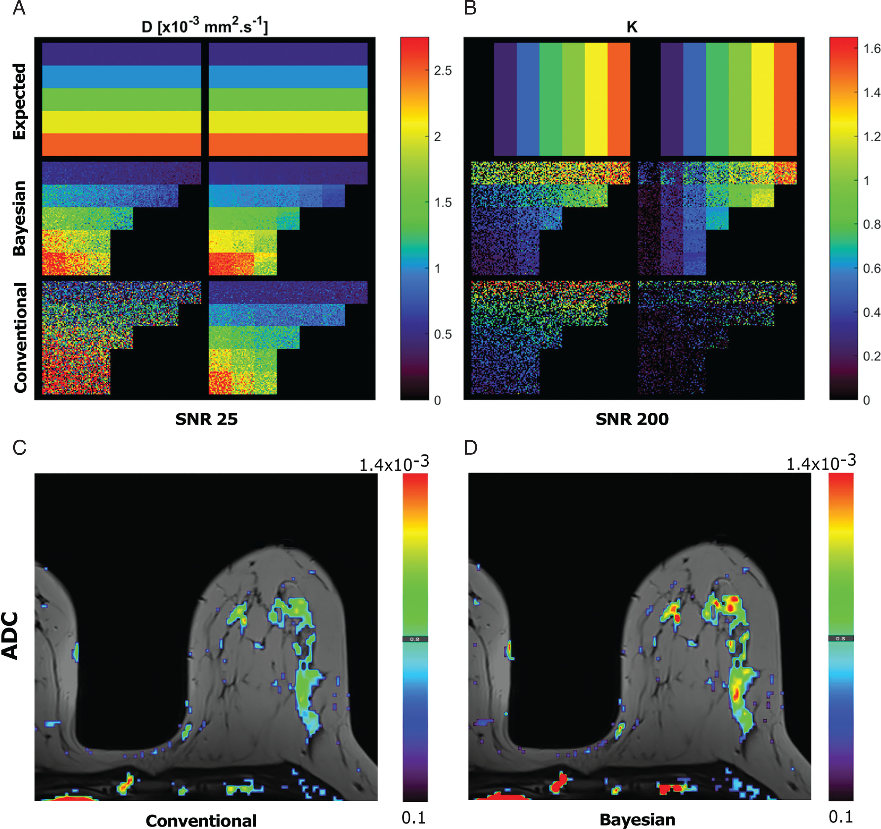 Diffusion-Weighted Imaging (DWI) for Breast Lesion Characterization ...