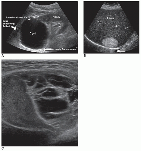 Orientation to Scanning | Radiology Key